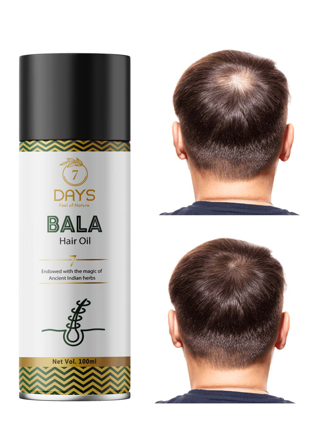 Buy 7 DAYS Bala Hair Regrowth Oil 100ml - Hair Oil for Unisex 25726234 ...